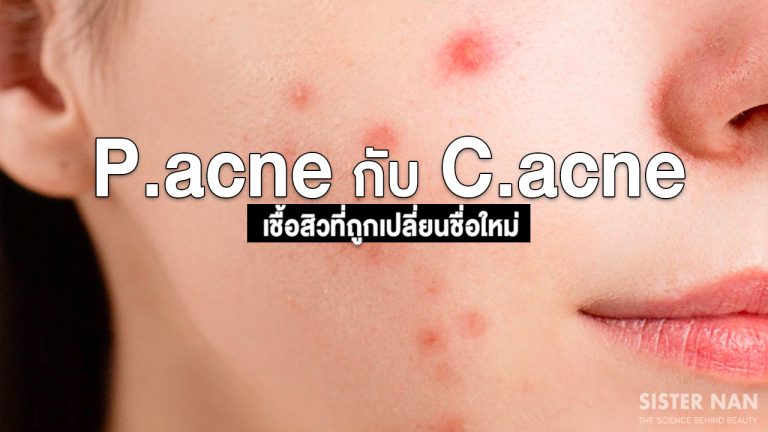 สิว P.acnes เปลี่ยนเป็น C.acnes - SISTER NAN : The Science Behind Beauty